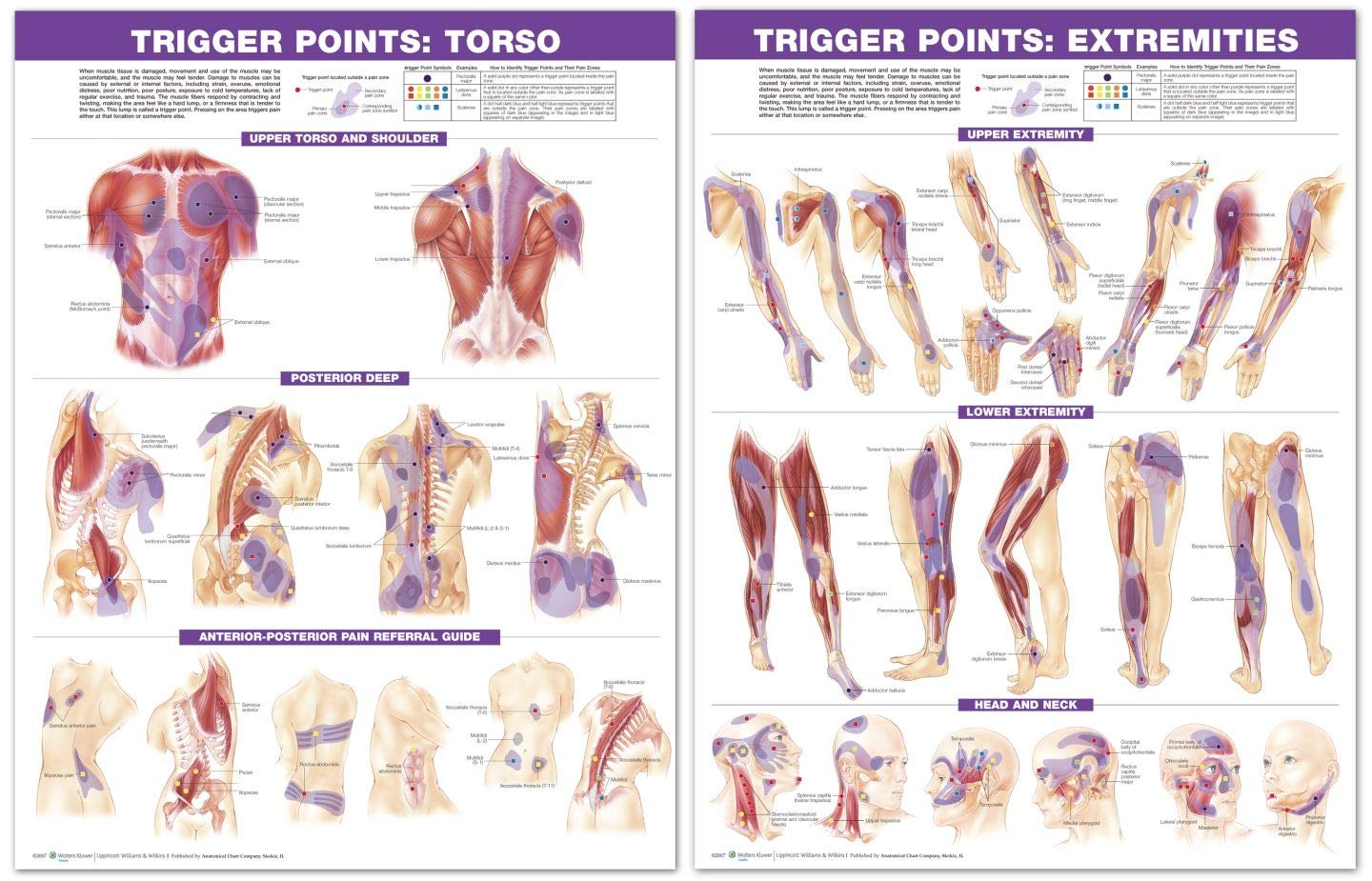 Trigger Point Chart Set: Torso & Extremities Lam: Extremities and Torso ...