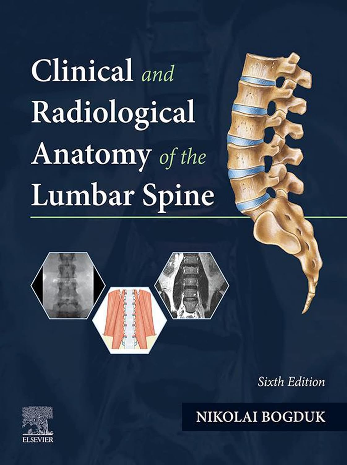 Clinical and Radiological Anatomy of the Lumbar Spine - E-Book eBook ...