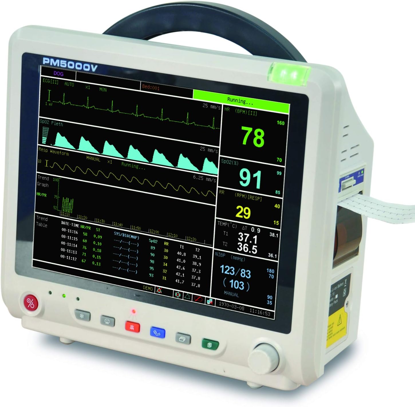 Utech PM5000V Veterinary Multi-parameters Monitor with SPO2, NIBP,Temp ...