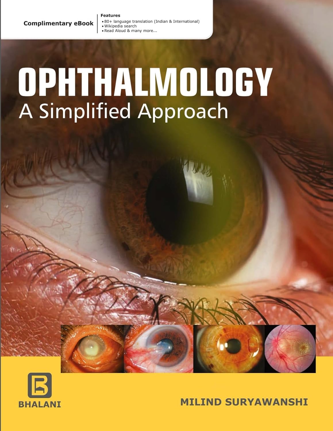 Buy Ophthalmology: A Simplified Approach, Medical Textbook with ...