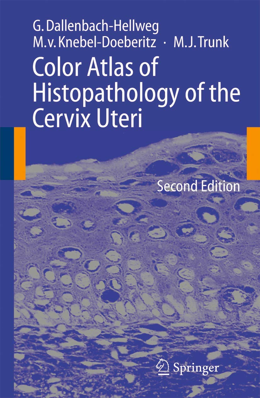 Color Atlas of Histopathology of the Cervix Uteri: 9783642064333 ...