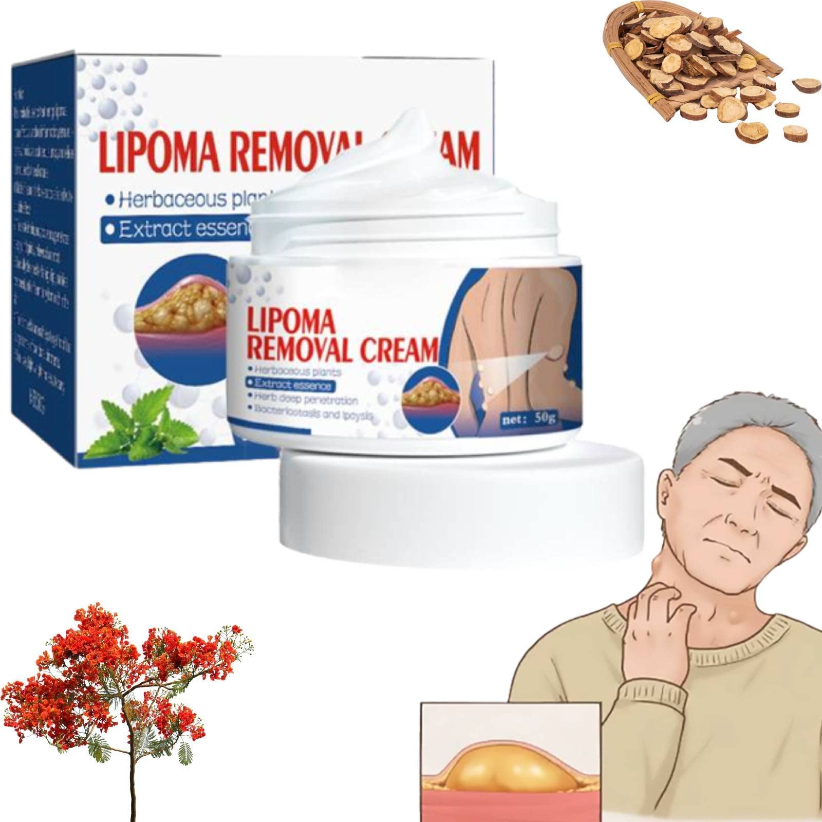 Buy ZWELRY Instant Lipoma Removal Cream - Lumpfree Lipoma Removal Cream ...