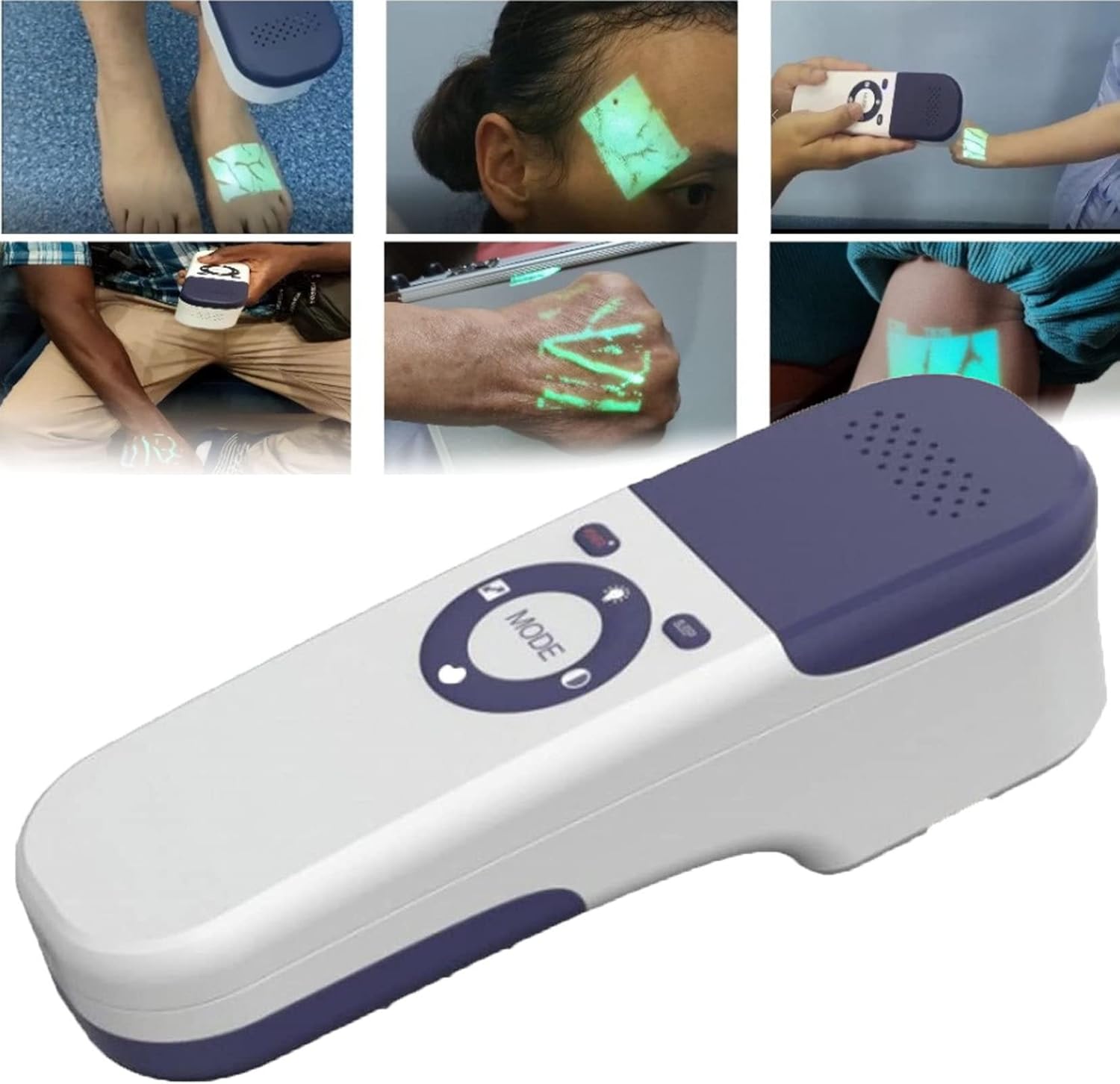 Amazon.com: RESKIU Vein Finder, Portable Vein Locator Detector w/7 ...