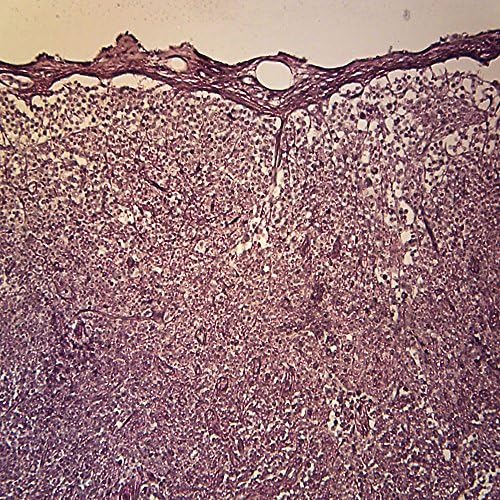 Lymph Node Microscope Slide