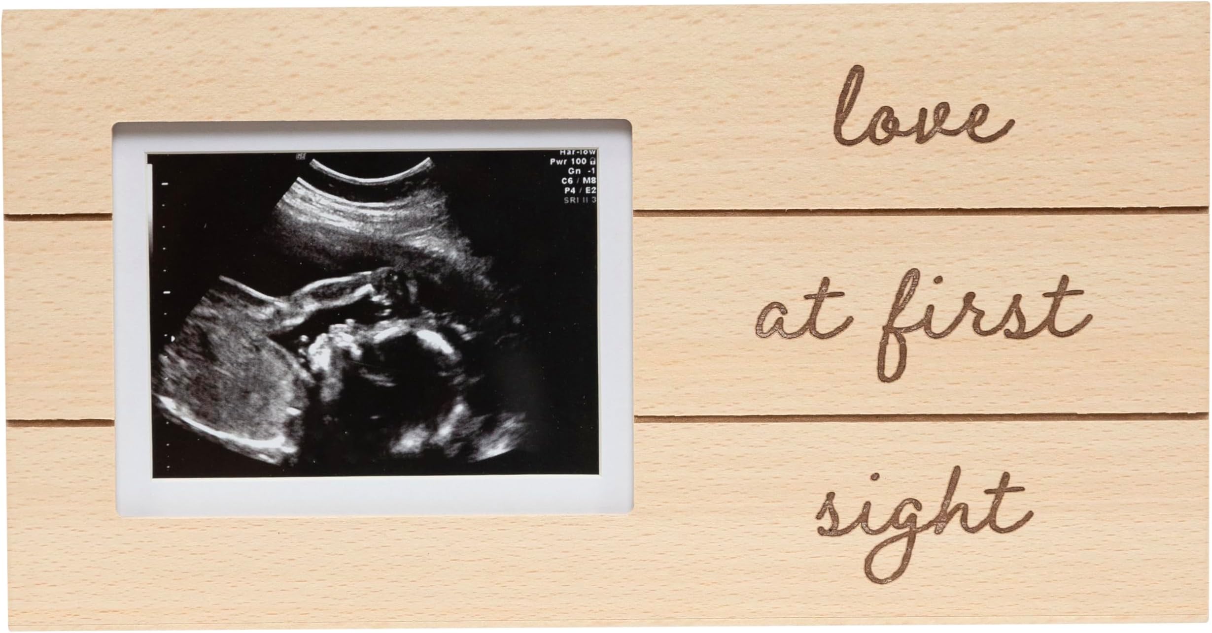 Amazon.com: Juvale Baby Sonogram Picture Frame for 4 x 3 Ultrasound ...