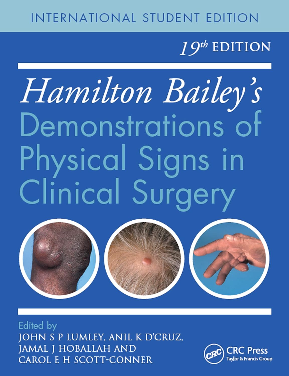Buy Hamilton Bailey's Demonstrations of Physical Signs in Clinical ...