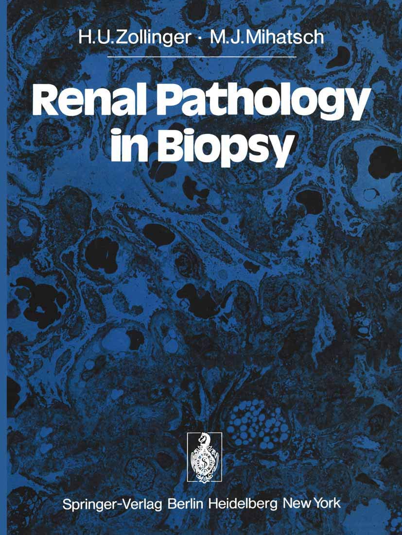 Renal Pathology in Biopsy: Light, Electron and Immunofluorescent ...