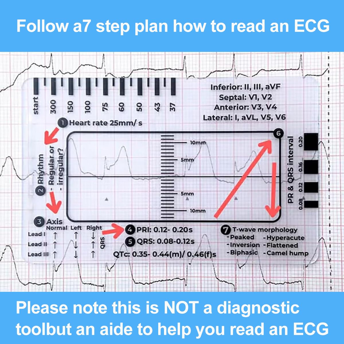 Snapklik.com : ECG 7 Step Ruler For EKG Interpretation - Transparent ...