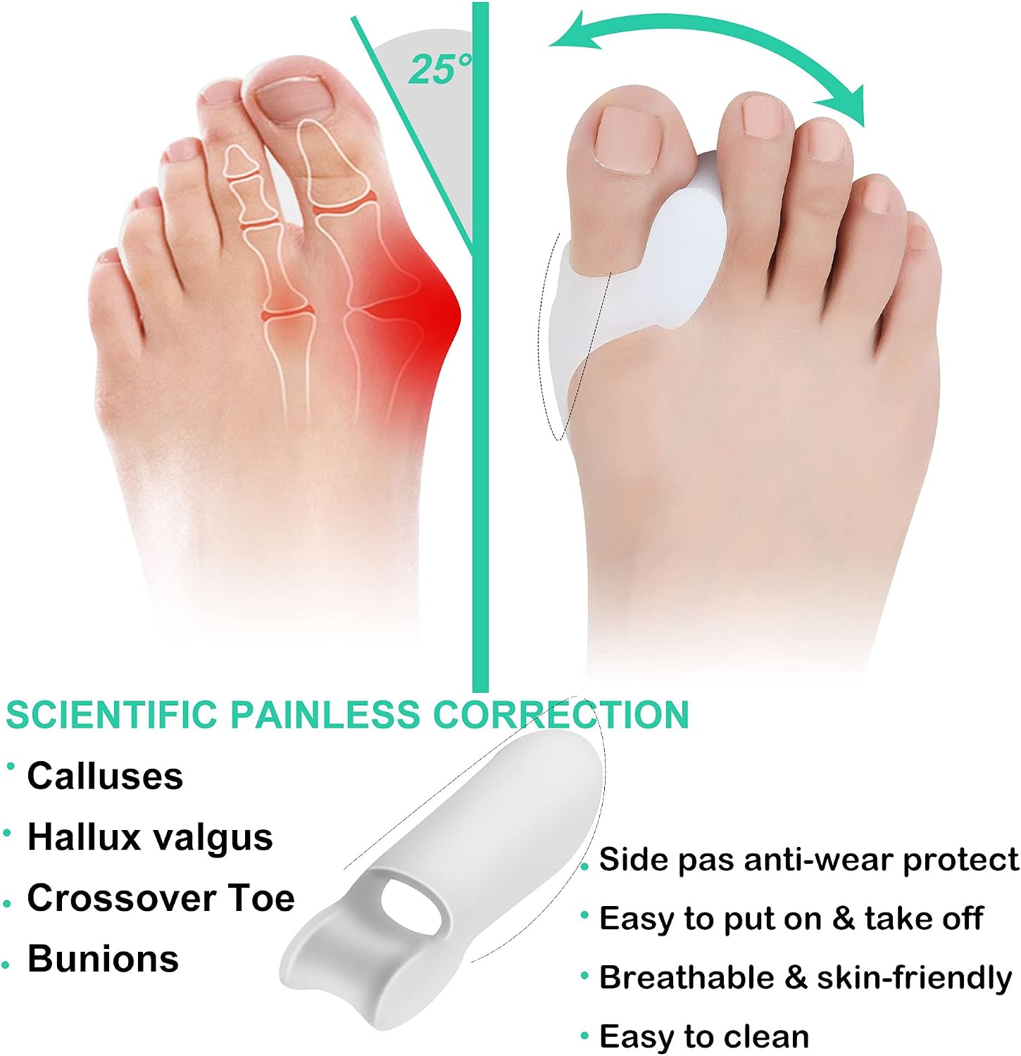10 Pack Gel Big Toe Separator and Bunion Protectors DYKOOK Gel Bunion ...