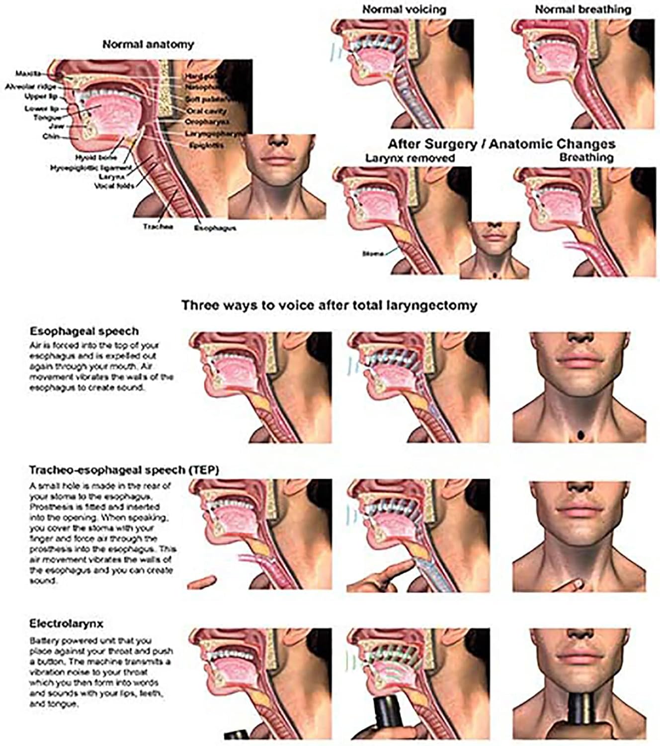YNB Electronic Poster for Anatomy of the Larynx of Human Larynx ...