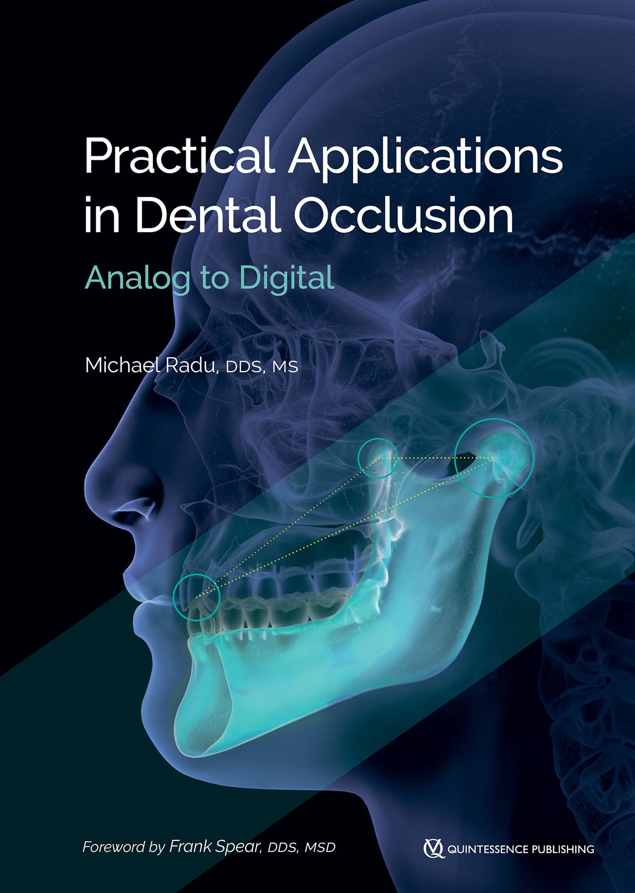 Amazon | Practical Applications in Dental Occlusion: Analog to Digital | Radu, Michael, Spear ...