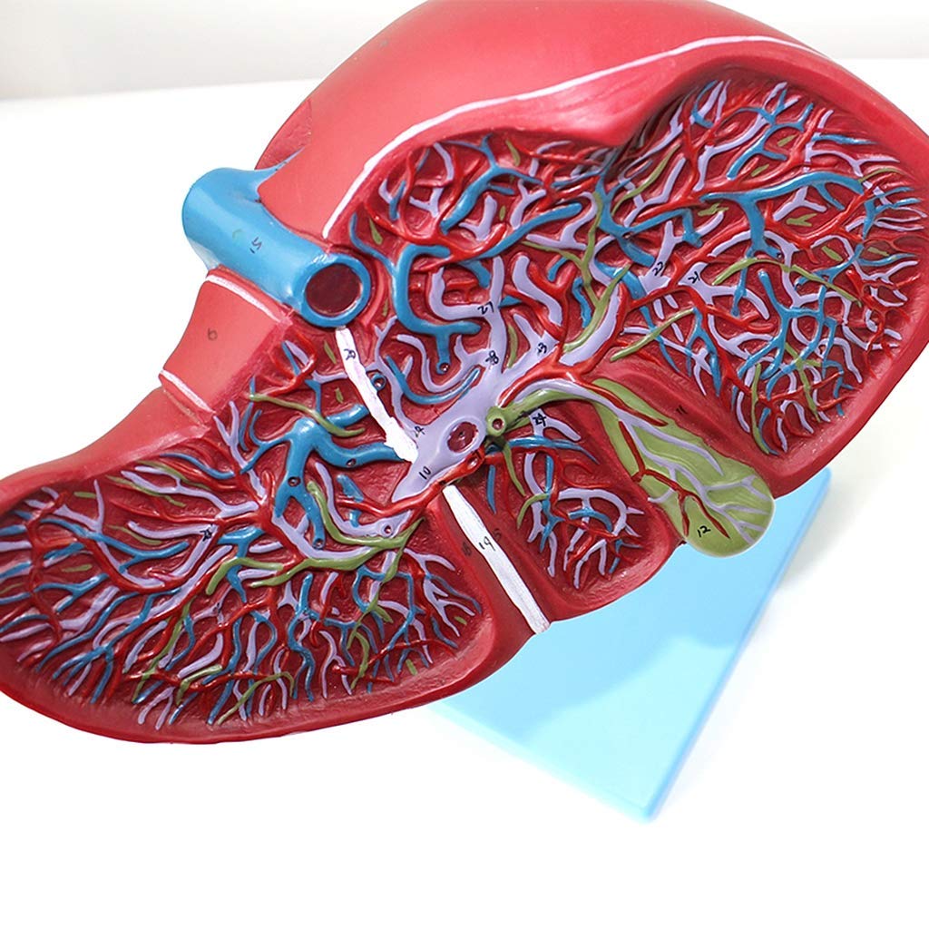 Buy Anatomical Liver Model - Human Liver Anatomy Model - Hepatobiliary ...