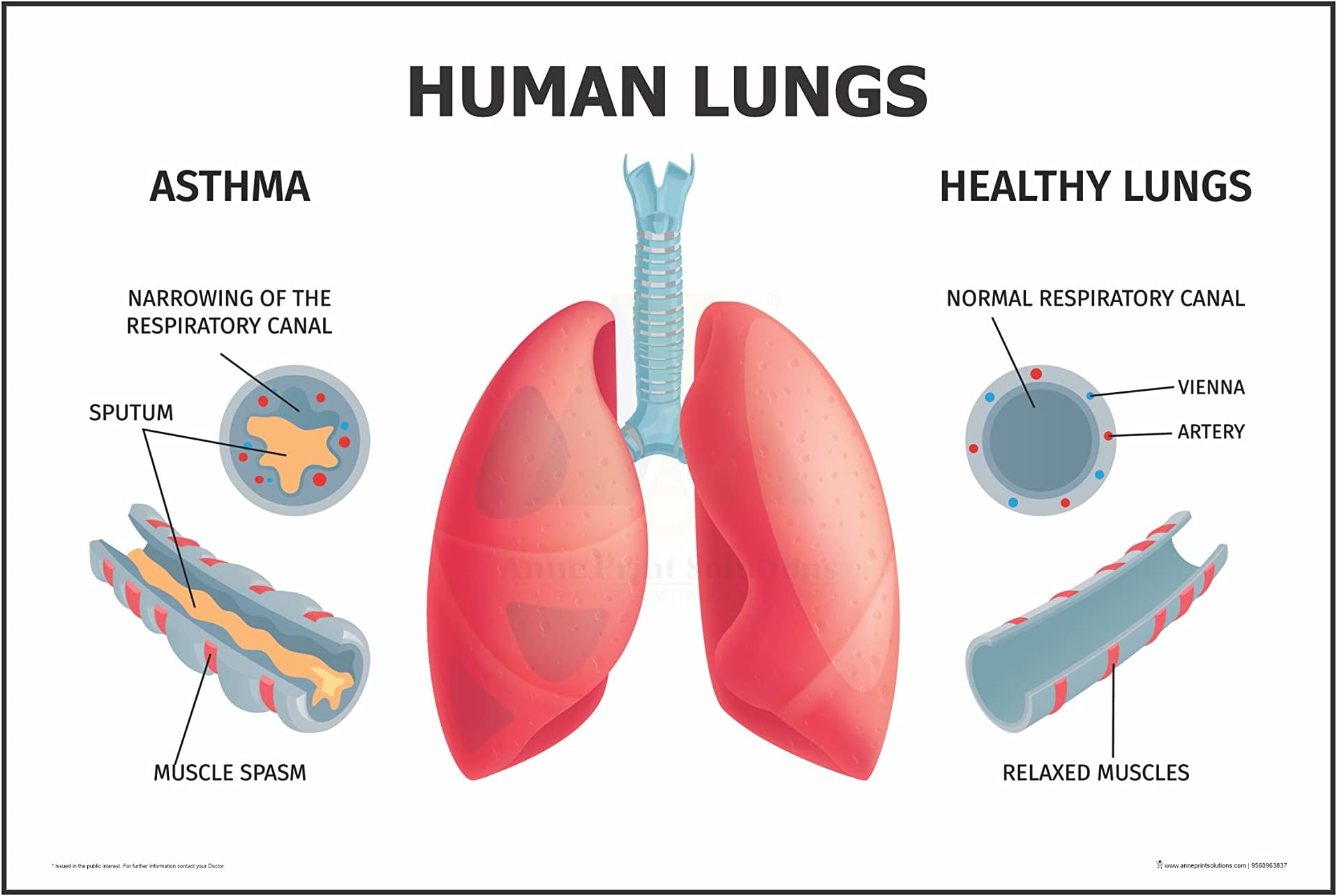 Anne Print Solutions® Human lungs chart Posters For Hospital Posters ...