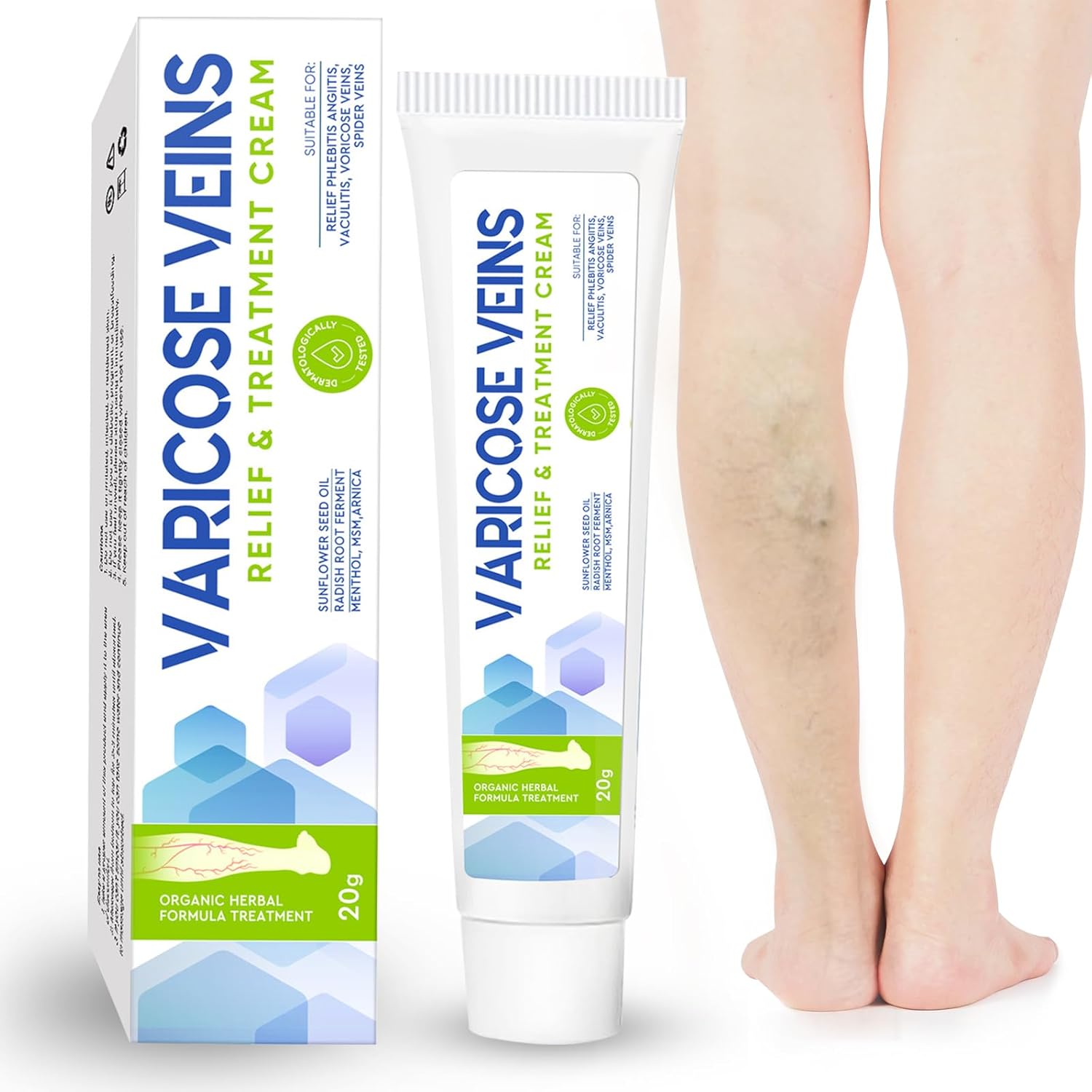 Amazon.com: MOSKILA Varicose Veins Treatment for Legs, Nature Varicose ...