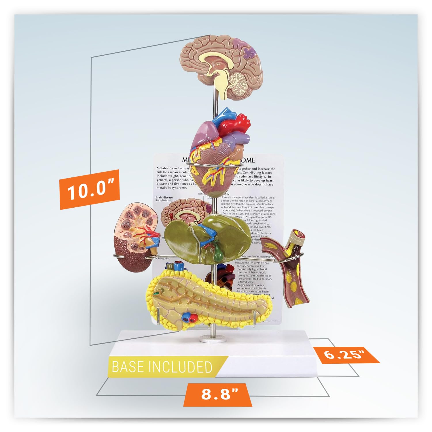 Snapklik.com : Metabolic Syndrome Model Set, Replica For Human Anatomy ...