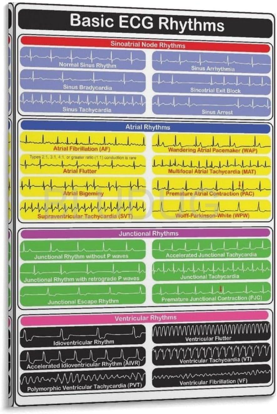 Amazon.com: SpArcz EKG Knowledge Poster,Basic ECG Rhythms Poster,EKG ...