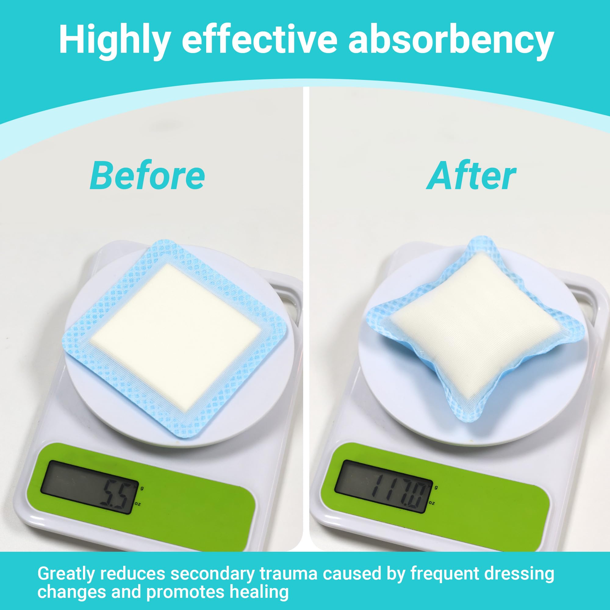 Snapklik.com : Conkote Super Absorbent Wound Dressings,4"x4" Non ...