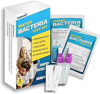 Urine Test: E. Coli Infections Explained | MedShun