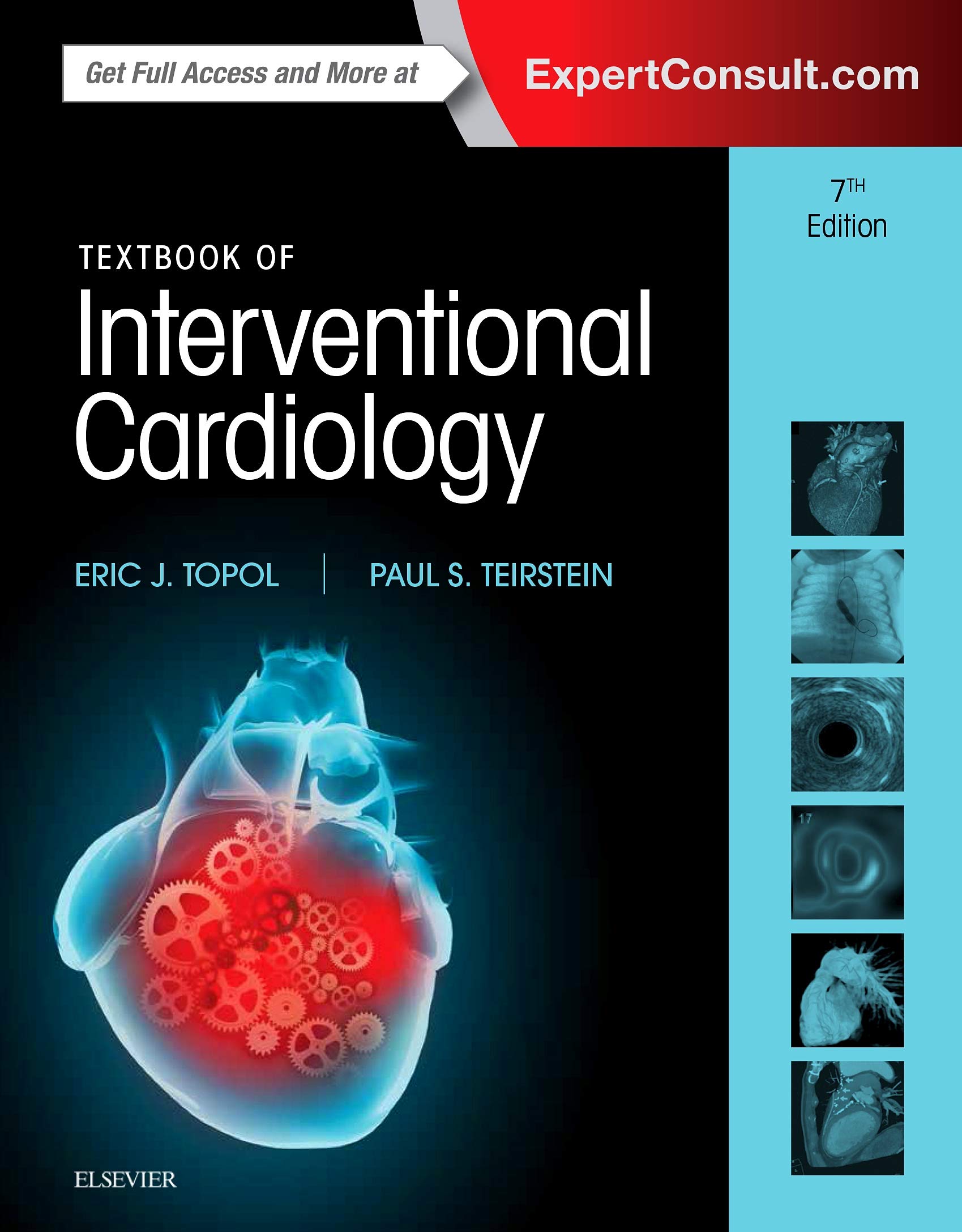 Textbook of Interventional Cardiology: Topol MD, Eric J., Teirstein MD ...