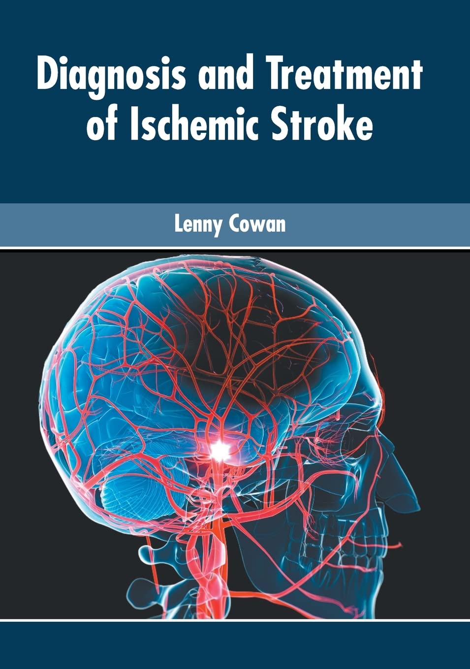 Buy Diagnosis and Treatment of Ischemic Stroke Book Online at Low ...