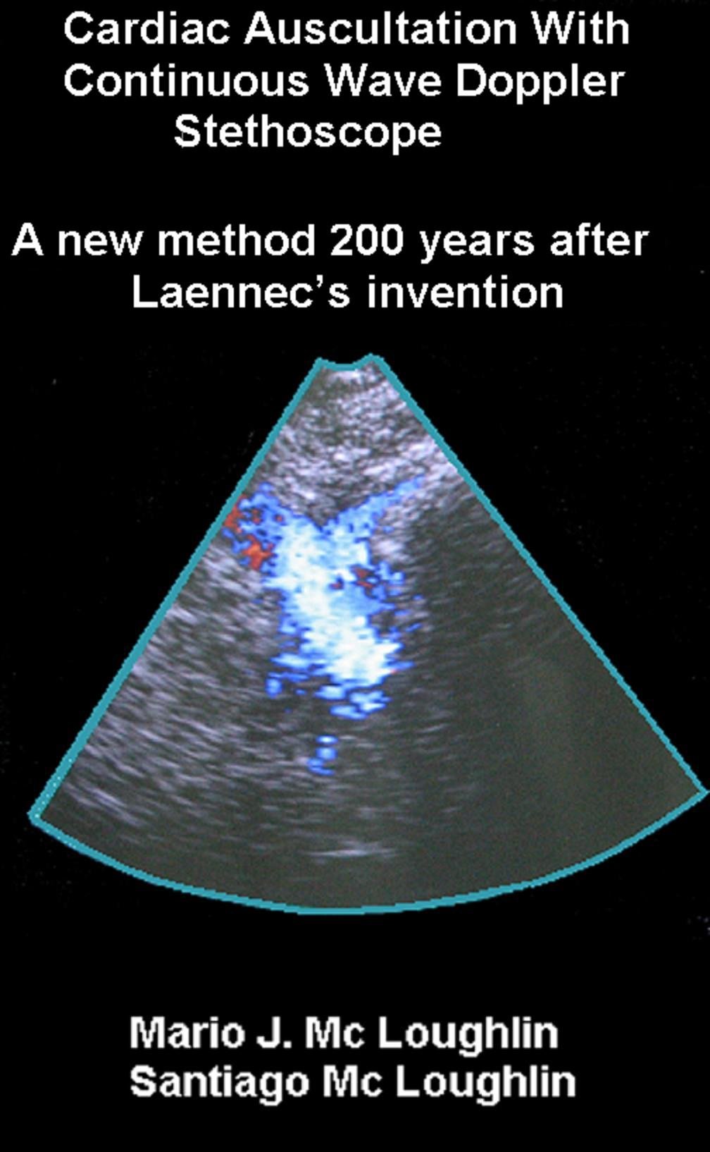 Buy Cardiac Auscultation With Continuous Wave Doppler Stetho: A new ...
