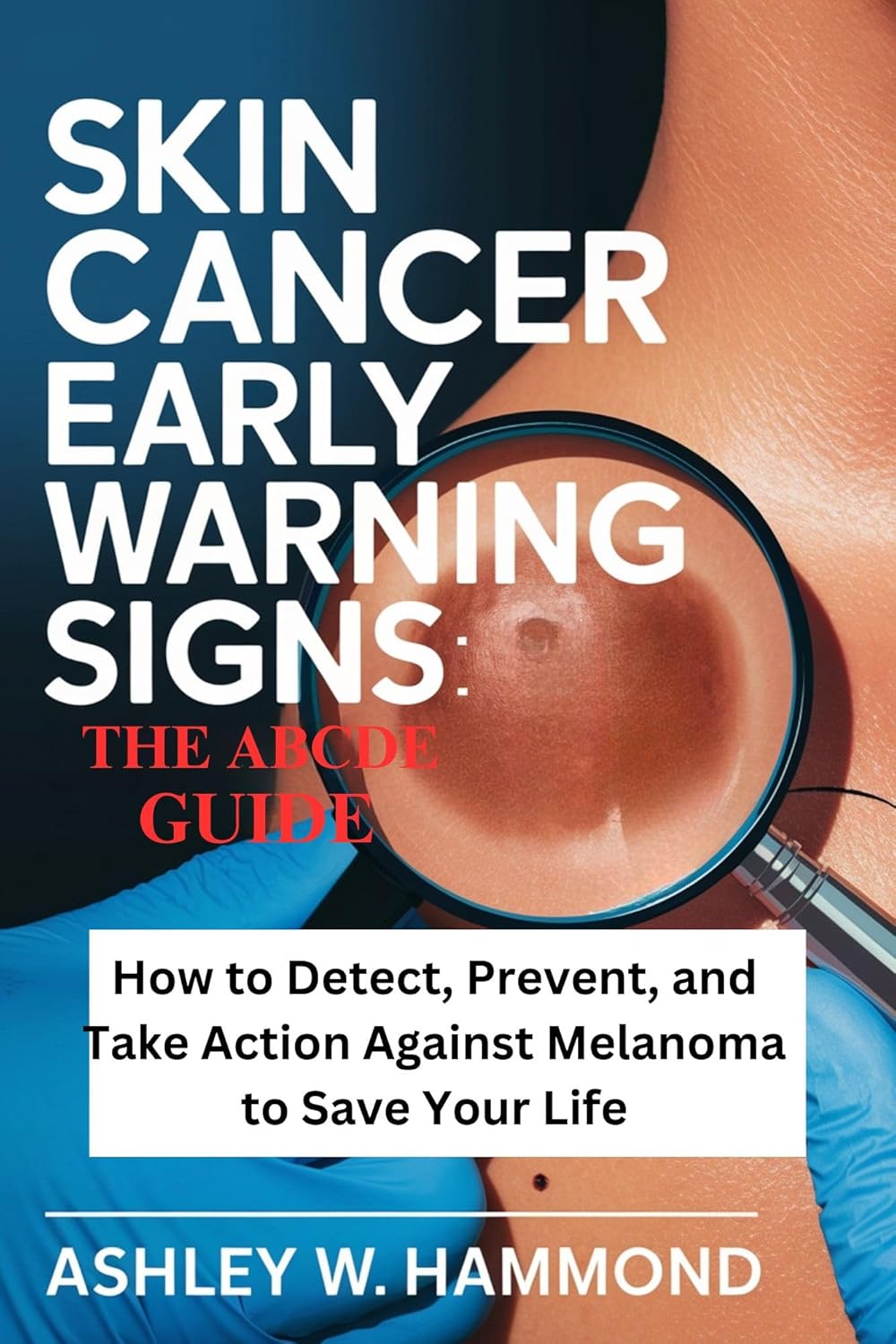 Skin Cancer Early Warning Signs: The ABCDE Guide: How to Detect ...