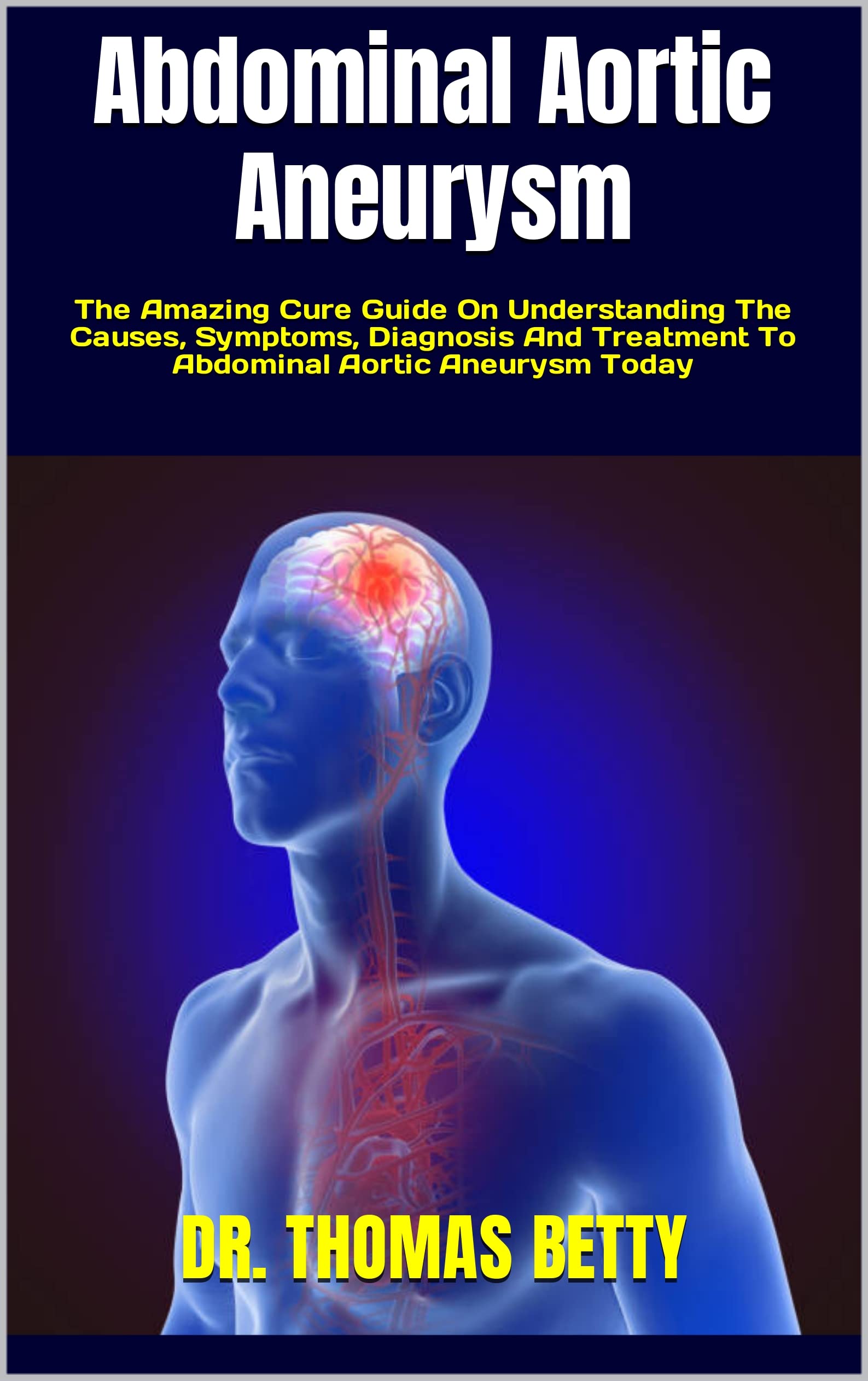Buy Abdominal Aortic Aneurysm : The Amazing Cure Guide On Understanding ...