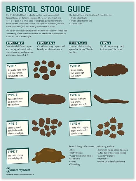 Anatomy Stuff Bristol Stool Chart Poster, 45 x 60 cm, 24x18 inches ...