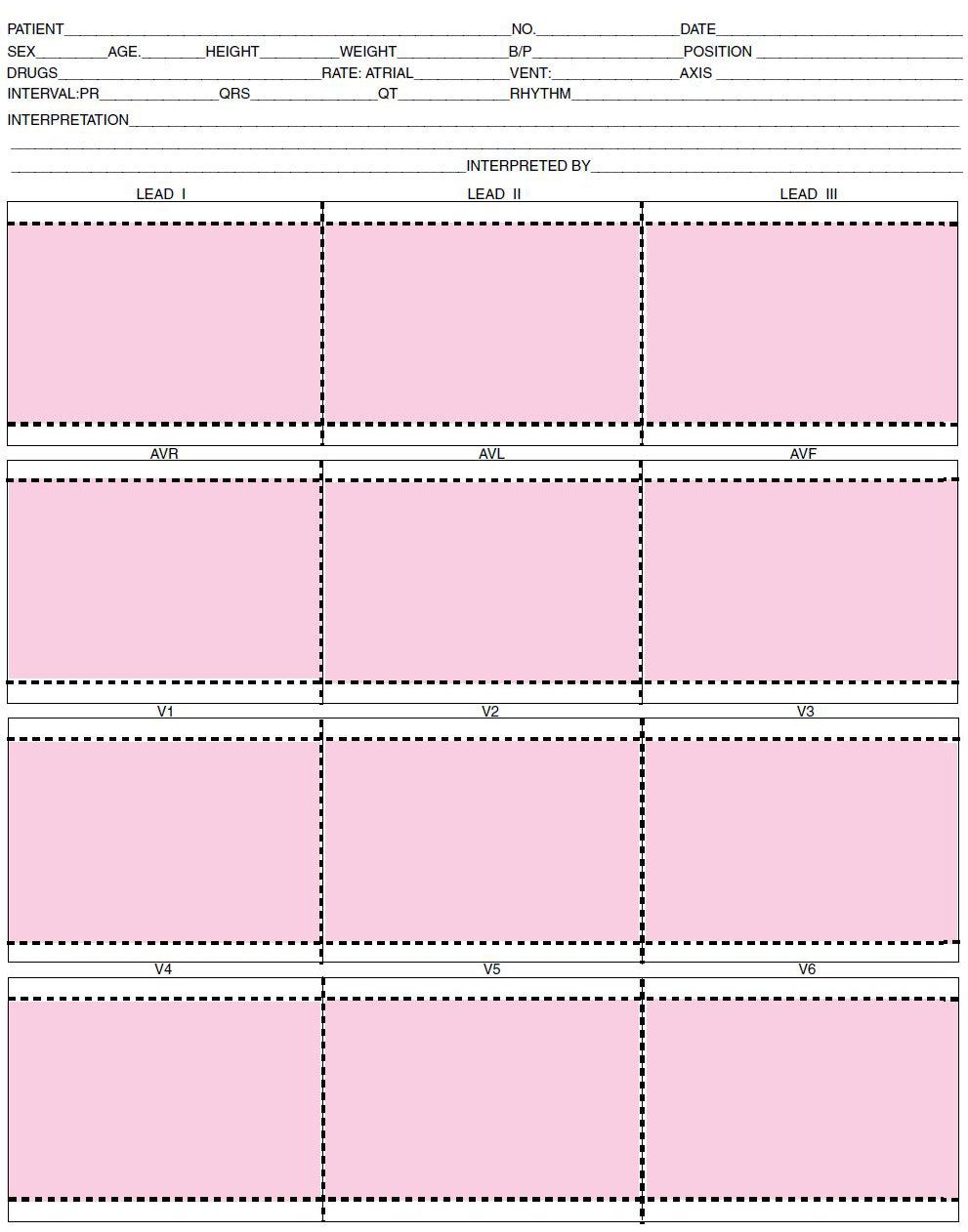 Amazon.com: ECG Mount for 12-Lead Tracing, 8 1/2" X 11" Portrait Mount ...