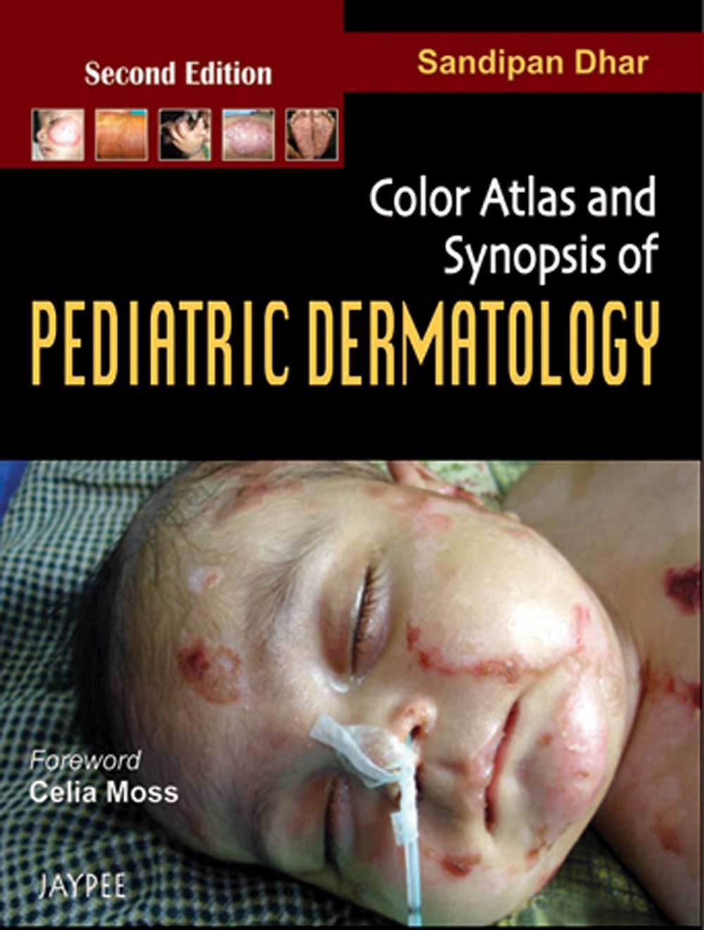 Color Atlas and Synopsis of Pediatric Dermatology: 9788184482843 ...