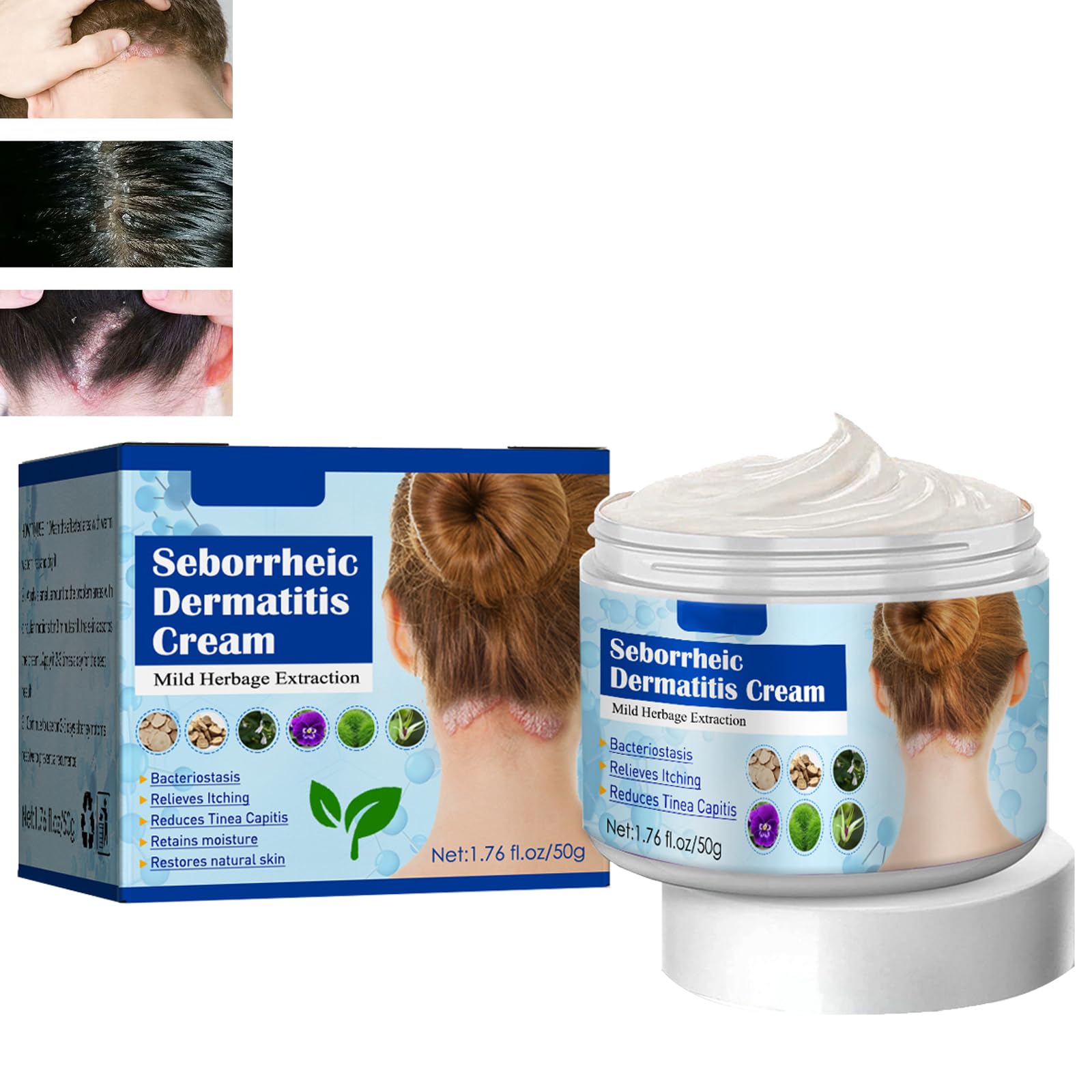 Buy Seborrheic Dermatitis Cream,Folliculitis ,Scalp Ringworm Skin ...