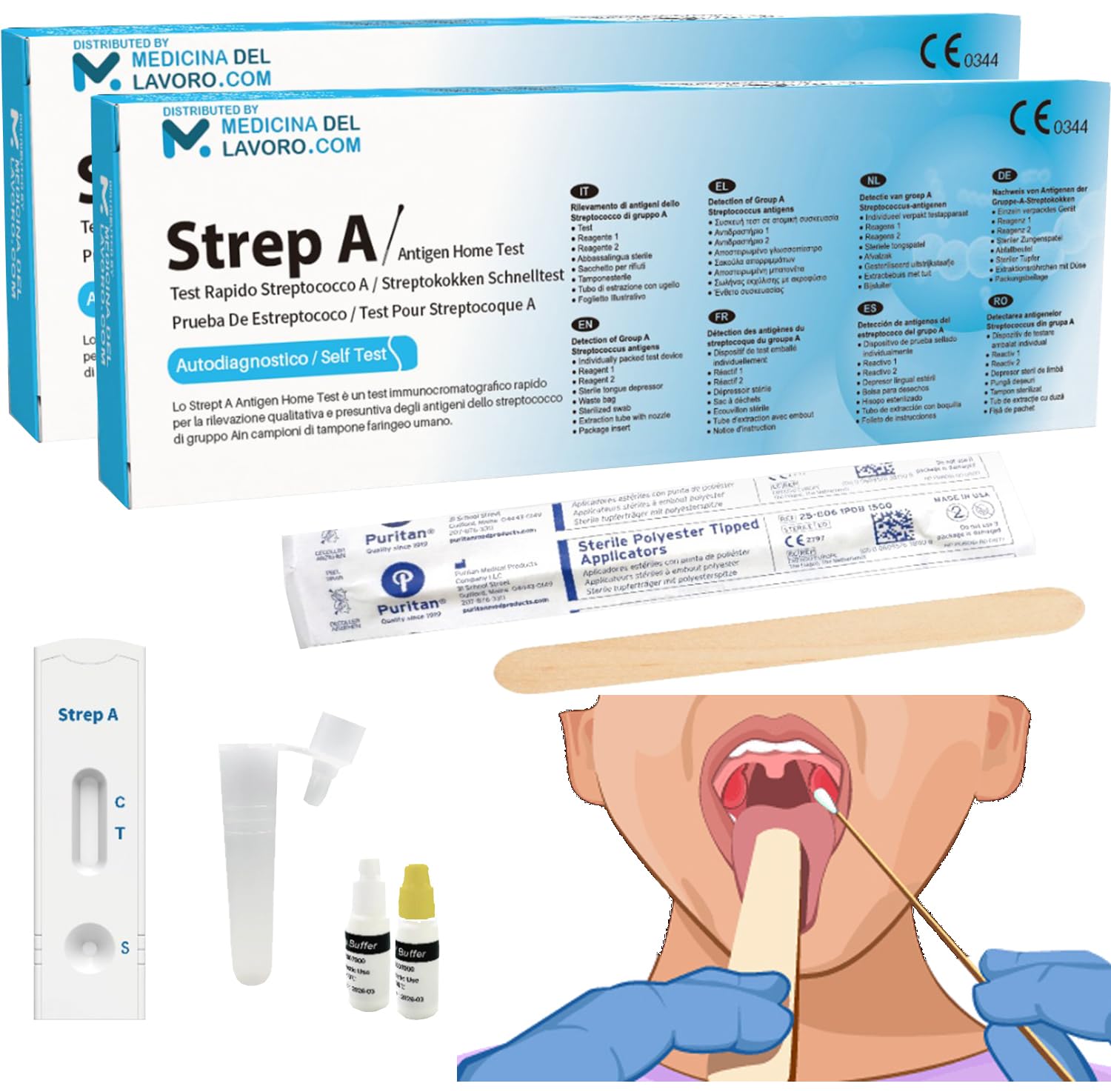 Test De Streptocoque De La Gorge Angine à Streptocoque : Symptômes,