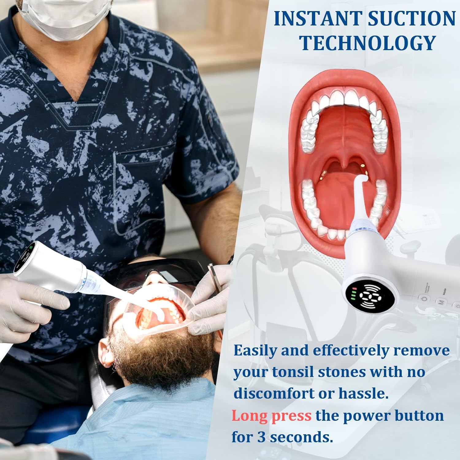 Electronic Tonsil Stone Vacuum Removal Kit with Built-in LED Light & 6 ...