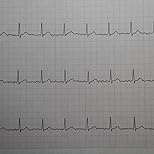 Amazon.co.jp: オムロンHCG-801用 心電図印刷ソフト HCG-SOFT-2 : 産業・研究開発用品