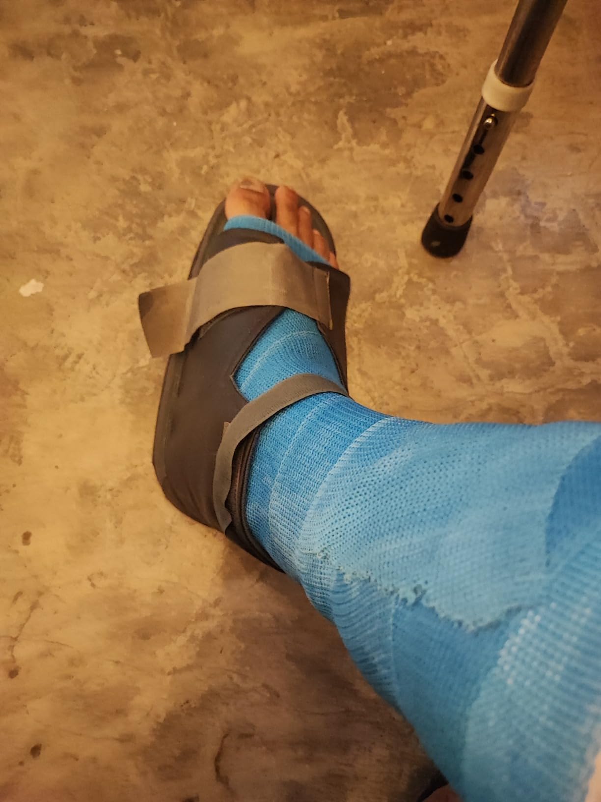 AP Orthopaedic Cast Nylex Shoe for foot Plaster & Orthopedic ankle ...