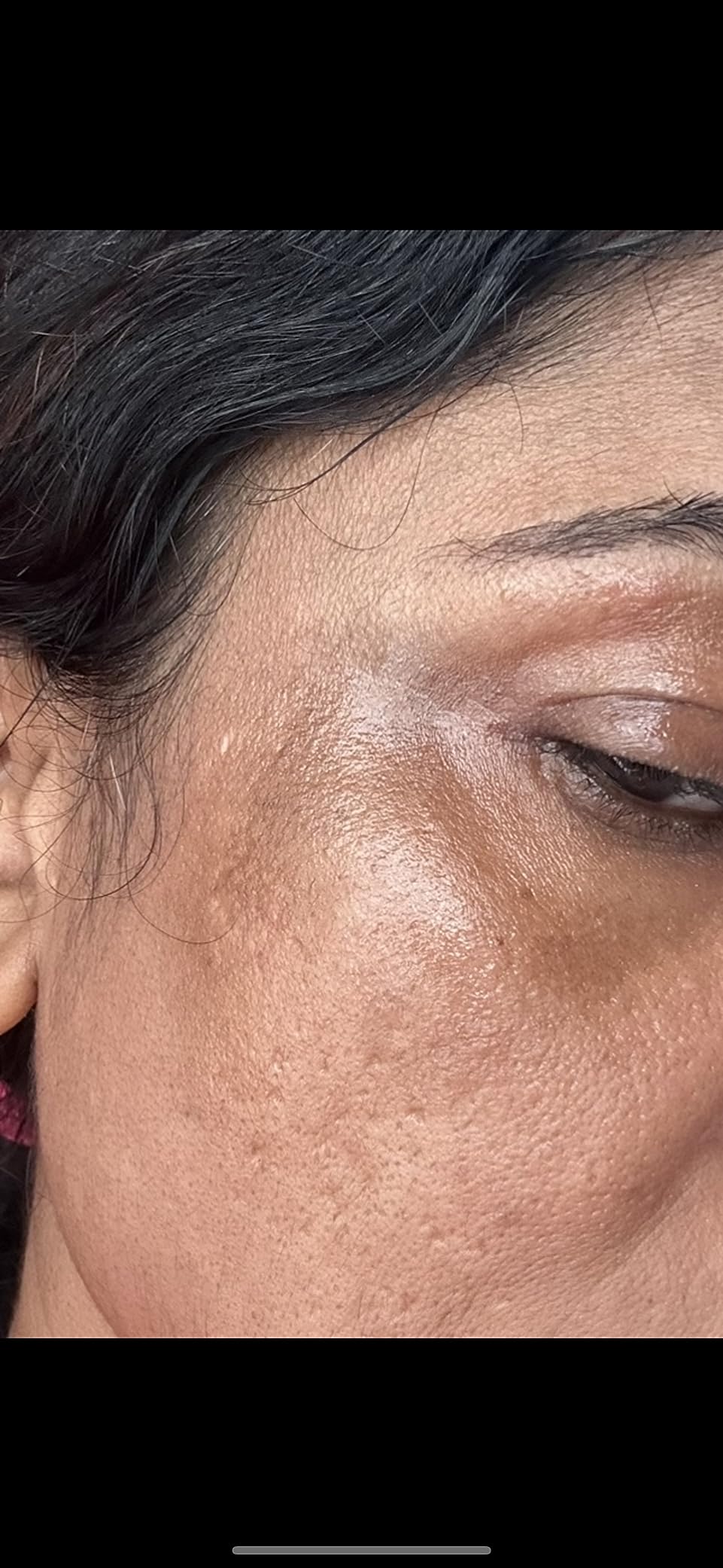 MODICARE ESSENSUAL INSTANTE TEA TREE OIL 15ml : Amazon.in: Beauty