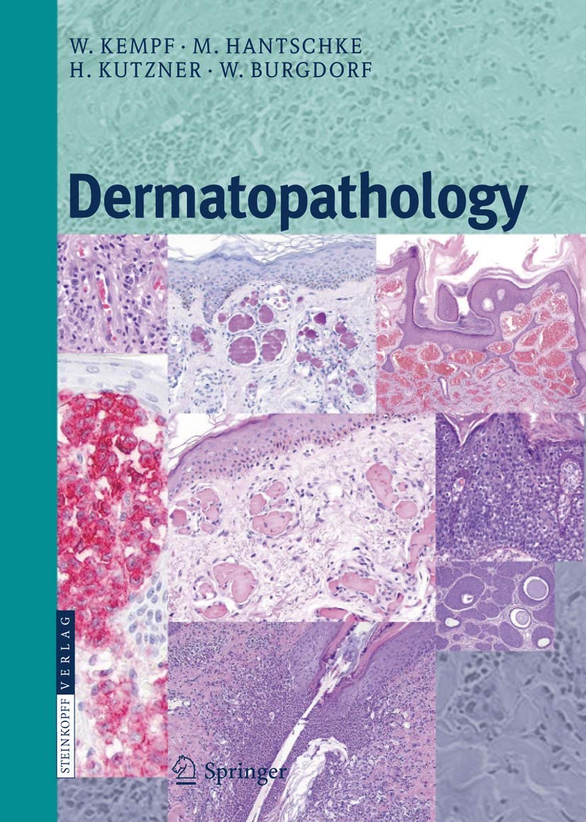 Dermatopathology: 9783662526873: Medicine & Health Science Books ...