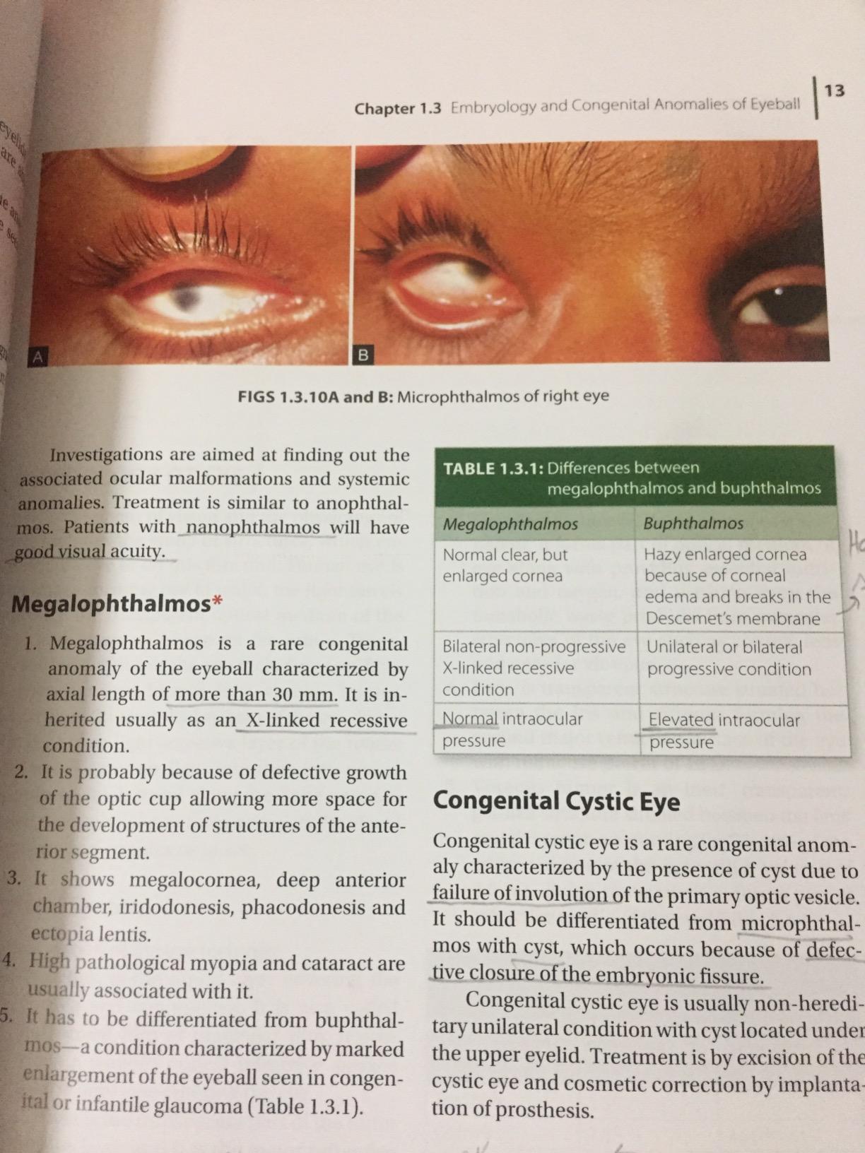 Buy Essentials of Ophthalmology Book Online at Low Prices in India ...
