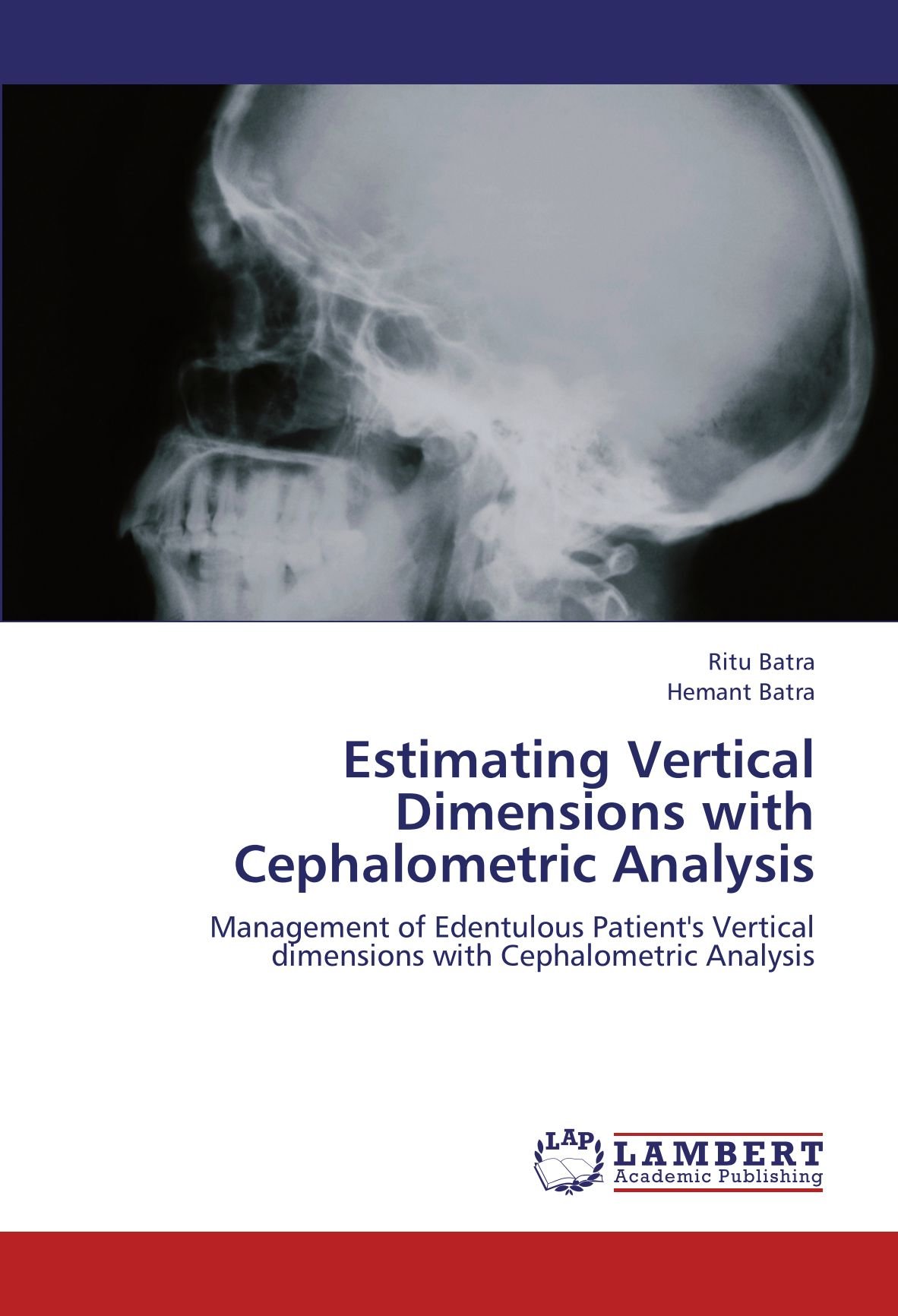 Estimating Vertical Dimensions With Cephalometric Analysis Management ...