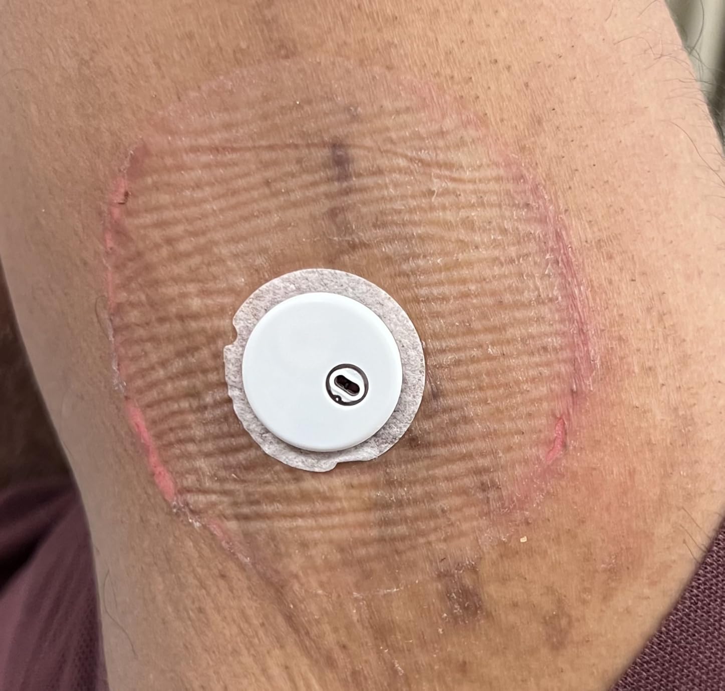 Homeaura 30Pcs Self-Adhesive Patch for Freestyle Libre Sensor Covers ...