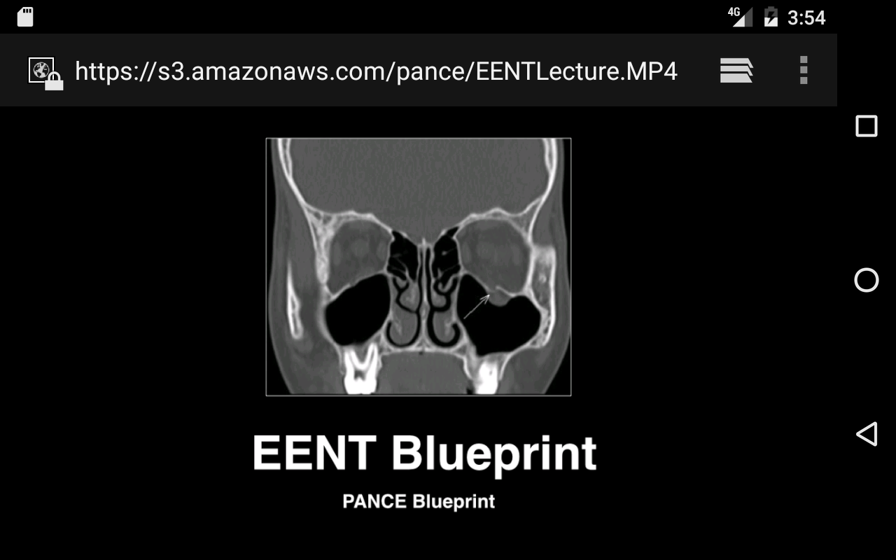 EENT Blueprint PANCE Review Course: app su Amazon Appstore