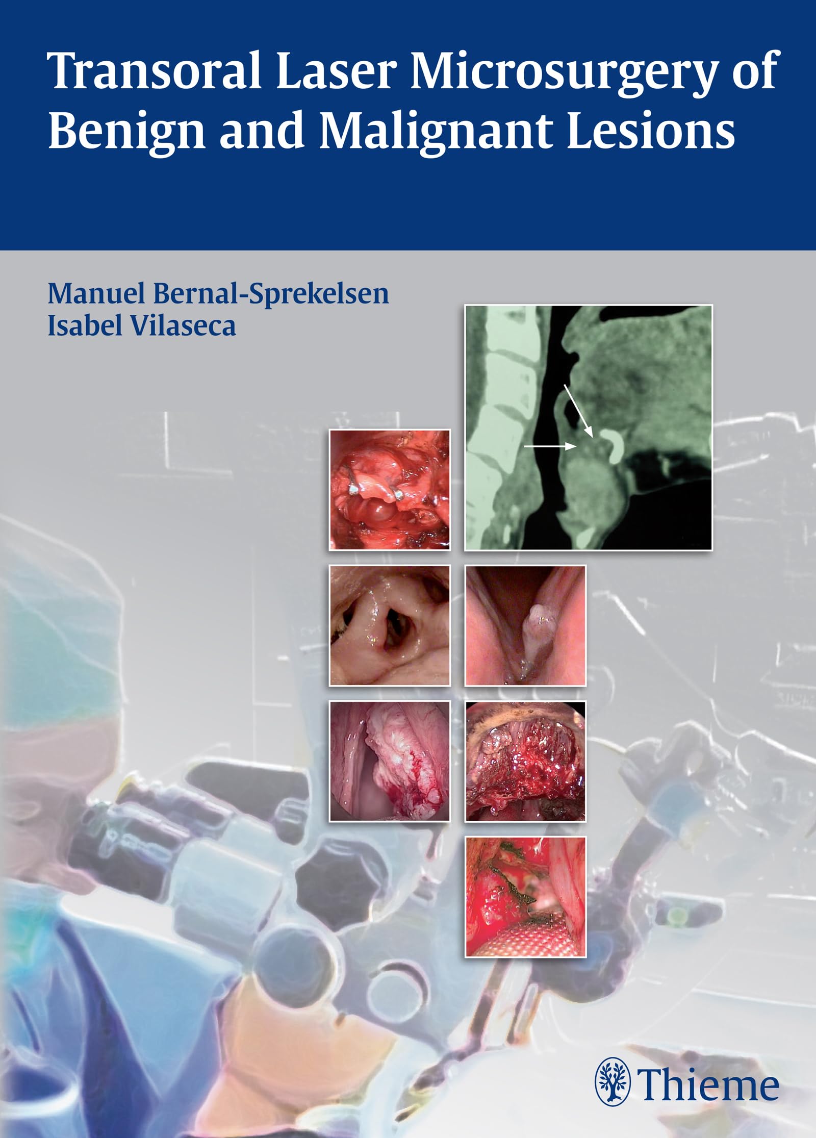 Transoral Laser Microsurgery of Benign and Malignant Lesions ...