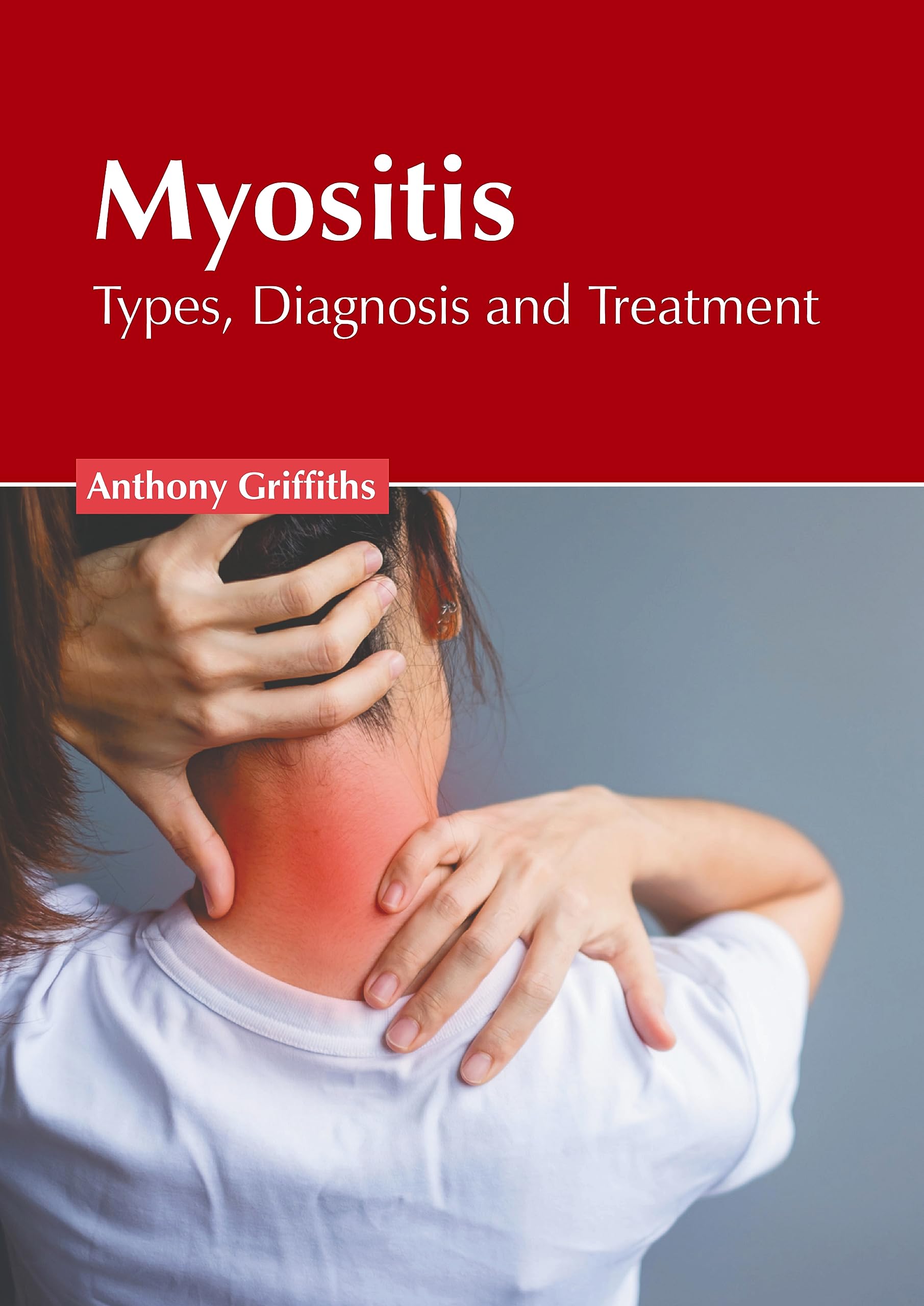 Amazon | Myositis: Types, Diagnosis and Treatment | Griffiths, Anthony ...