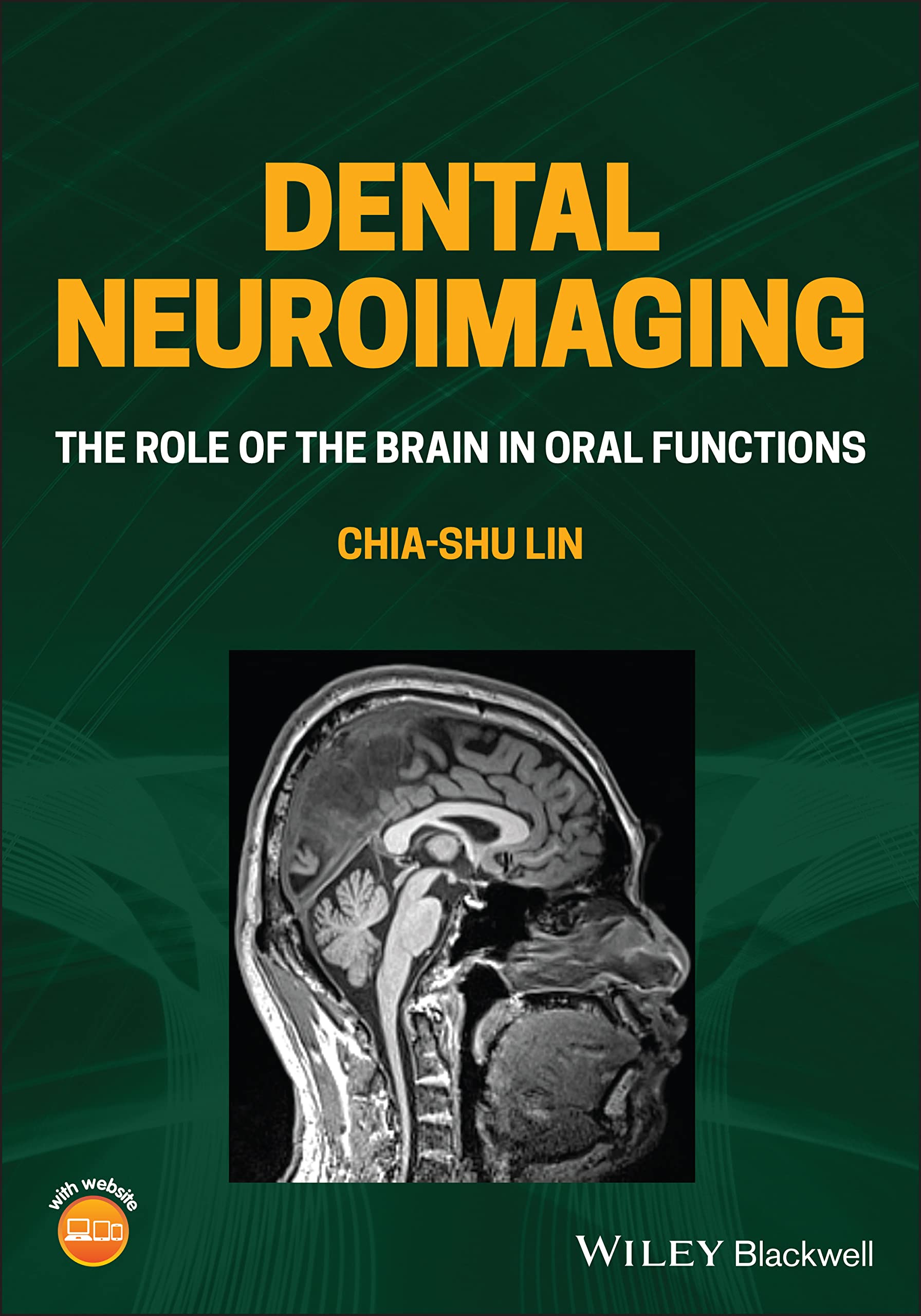 Dental Neuroimaging: The Role of the Brain in Oral Functions ...