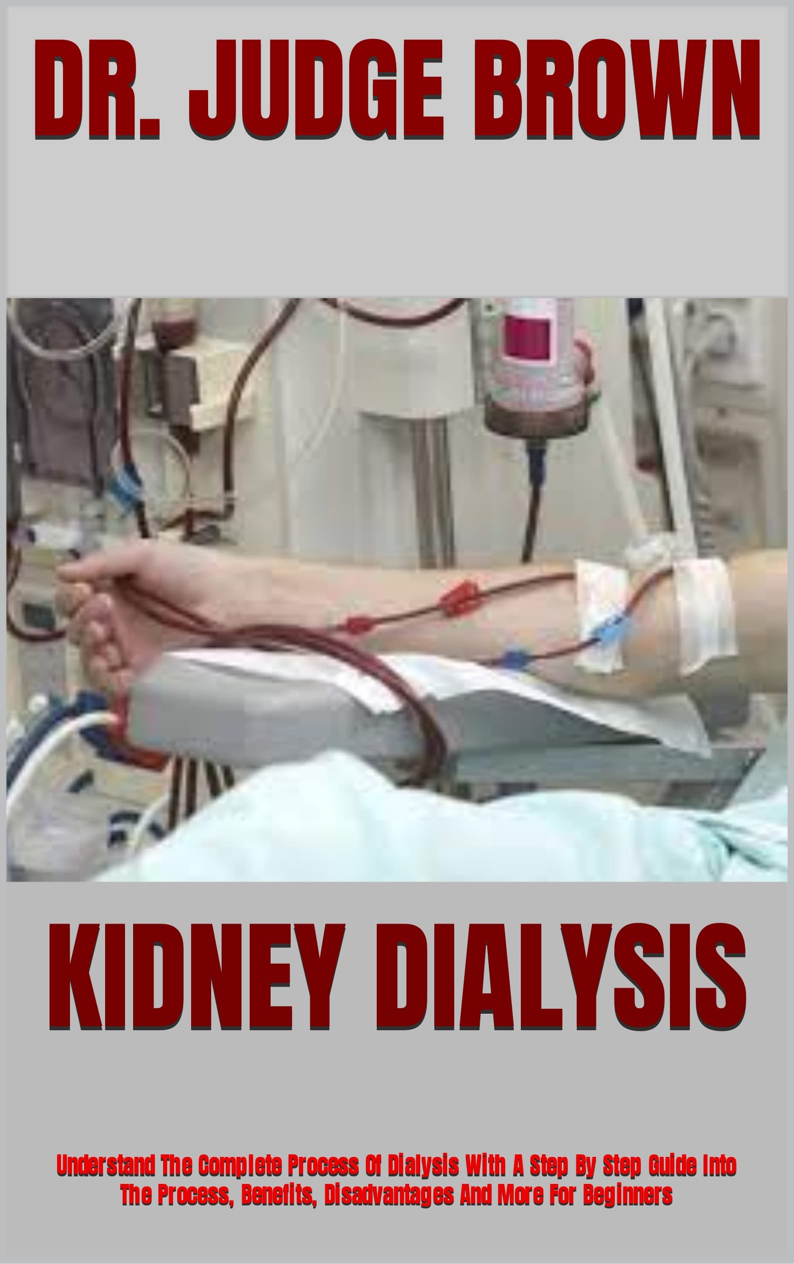 Buy KIDNEY DIALYSIS : Understand The Complete Process Of Dialysis With ...