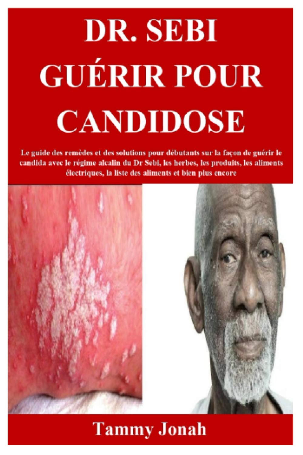 Dr Sebi Guerir Pour Candidose Le Guide Des Remedes Et | Desertcart ...