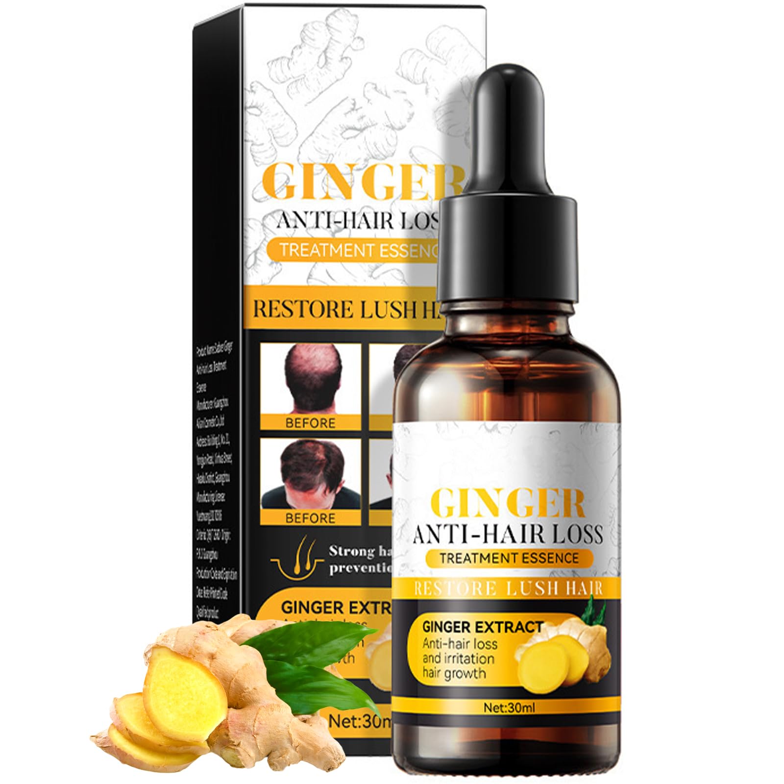 Ginger Anti-Hair Loss Oil - 30ml Strong Root Fixation Ginger Organic ...