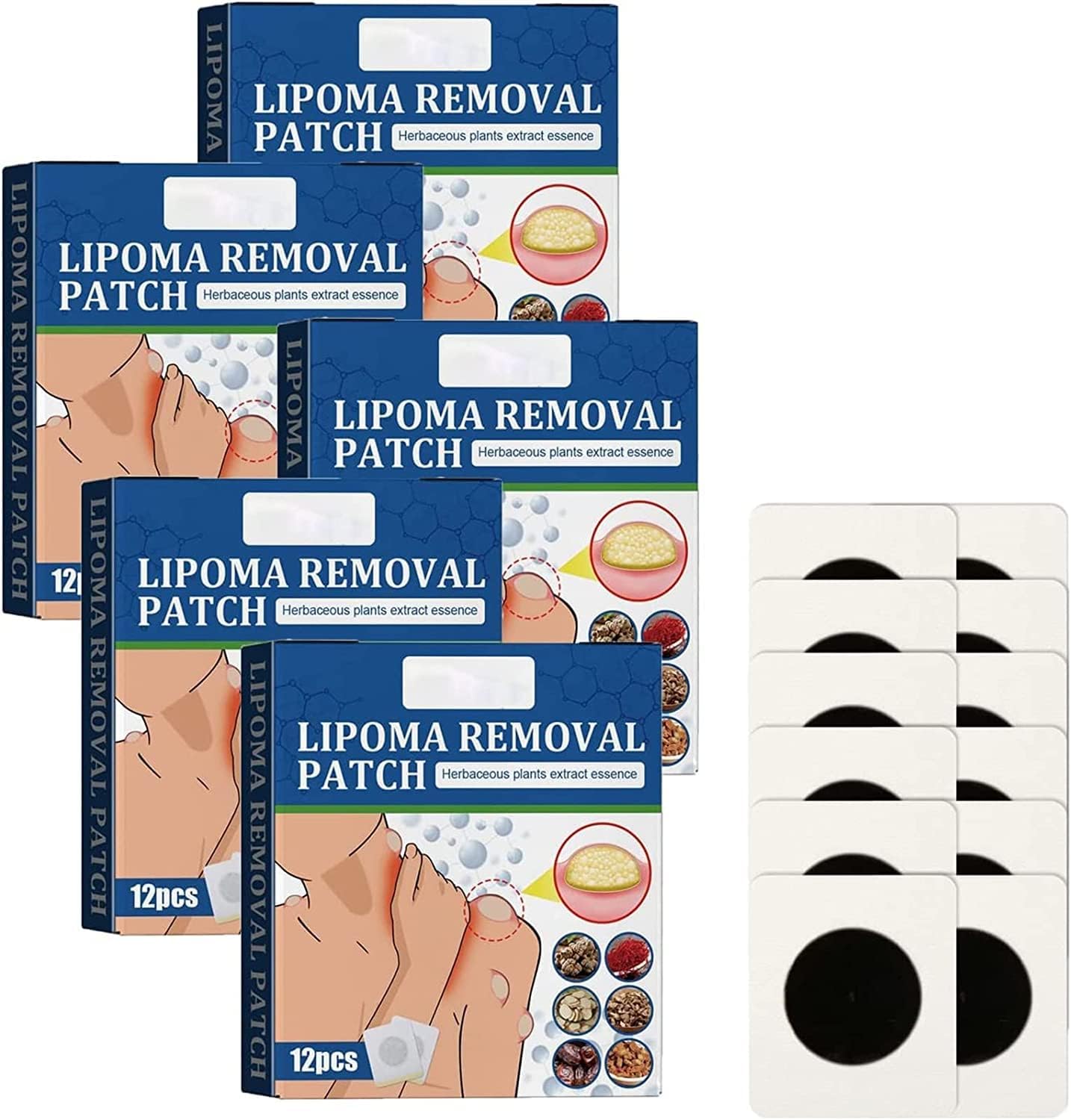 M-EDix Lipoma Removal Patch,Lymphatic Care Patch,Soothe Body Fat Knots ...
