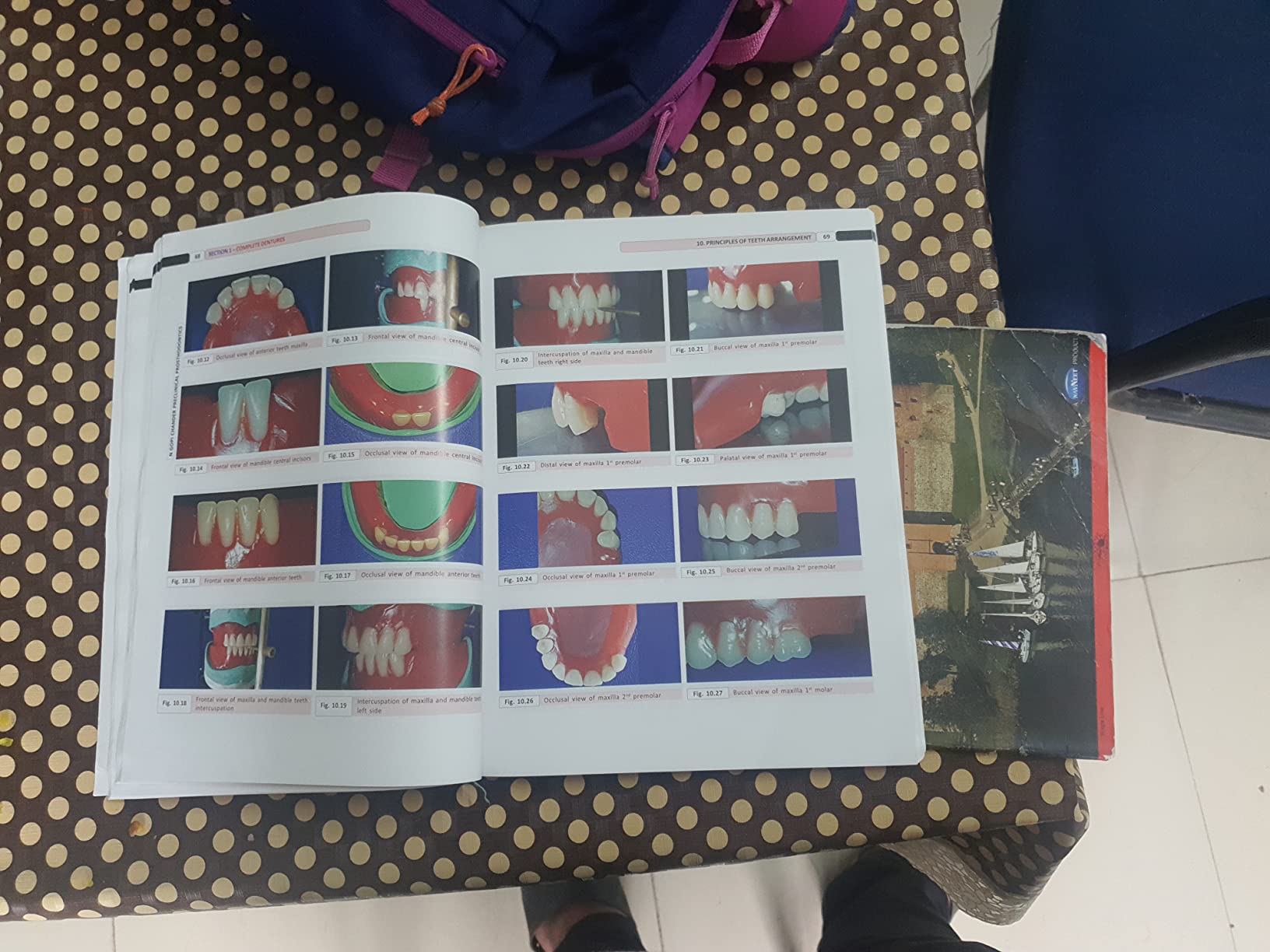 Pre Clinical Prosthodontics : N Gopi Chander, V Rangarajan, T V ...
