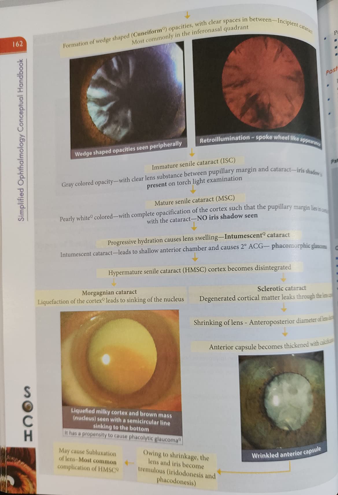 Buy SOCH (Simplified Ophthalmology Conceptual Handbook) 5th Ed. (PB ...